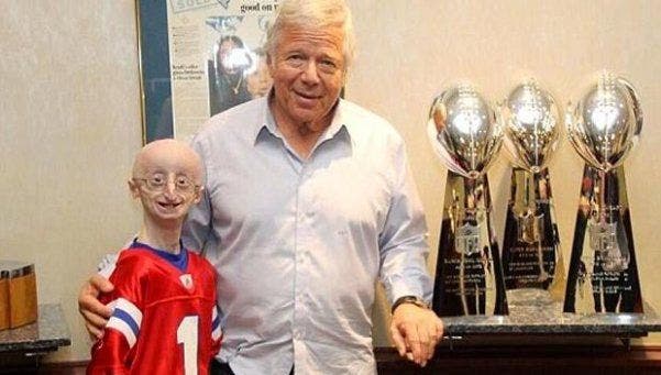 A los 17 años, murió el Benjamin Button de la vida real